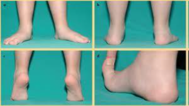 Children’s Foot Problems – Bath Podiatry